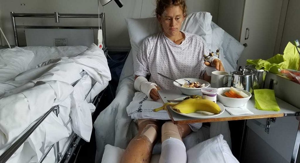 After Near-Fatal Fall, Hillary Allen Finds Strength in Silver Linings ...